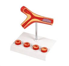Atherosclerosis And Thrombosis Model - Mechanical Lab Equipment's
