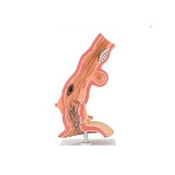 Pathological Model Of Esophagus - Mechanical Lab Equipment's