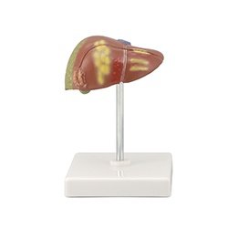 Pathological Model Of The Human Liver - Mechanical Lab Equipment's