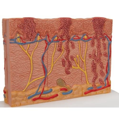 Skin Cancer Model - Mechanical Lab Equipment's